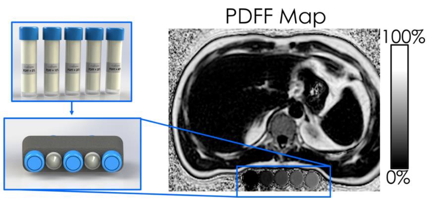 脂肪定量MRIファントム｜MRIファントムならアクロバイオ